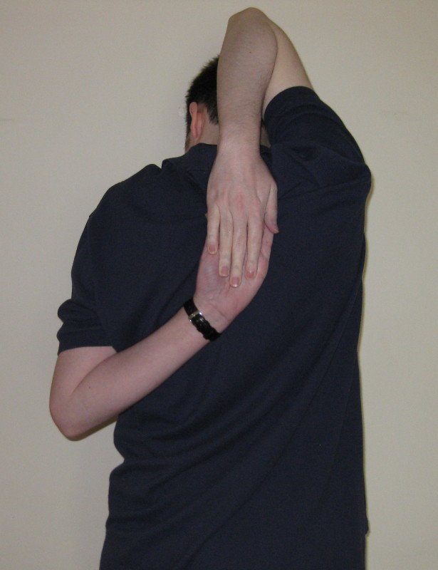 Shoulder Hypermobility :: A Reluctant Contortionist